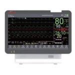 Multipara Monitor: Guide, Features, Prices & Best Brands Compared ...