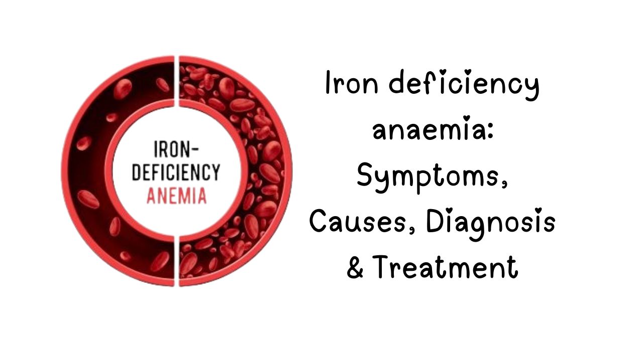 Iron deficiency anemia: Symptoms, Causes, Diagnosis & Treatment - QuickHealthLife