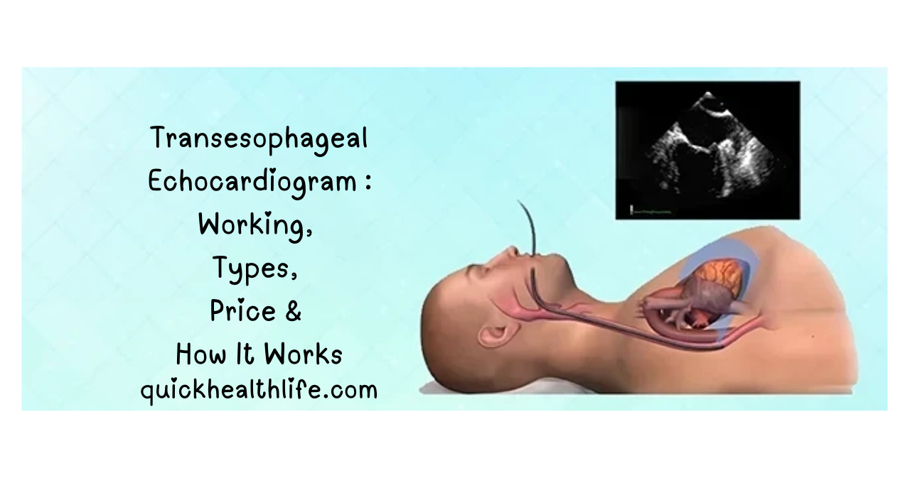 Transesophageal Echocardiogram (TEE): Working, Types, Price & How It ...