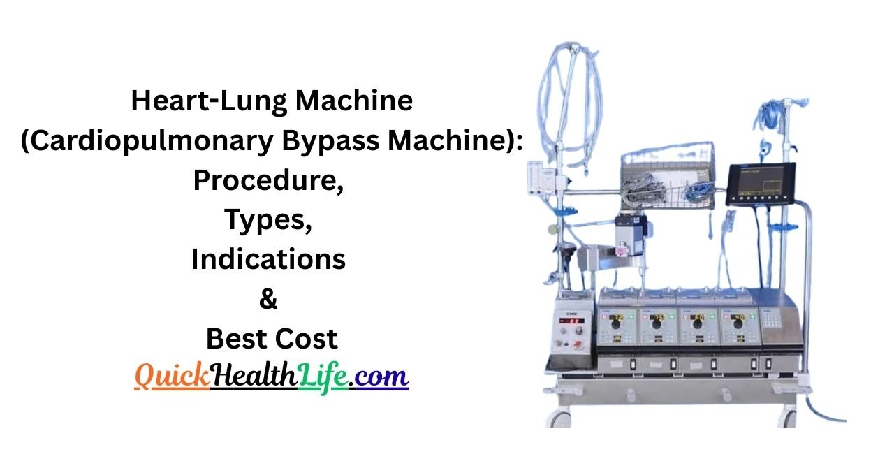 Heart-Lung Machine (Cardiopulmonary Bypass Machine): Procedure, Types ...