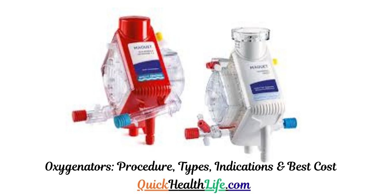 Oxygenators: Procedure, Types, Indications & Best Cost - QuickHealthLife