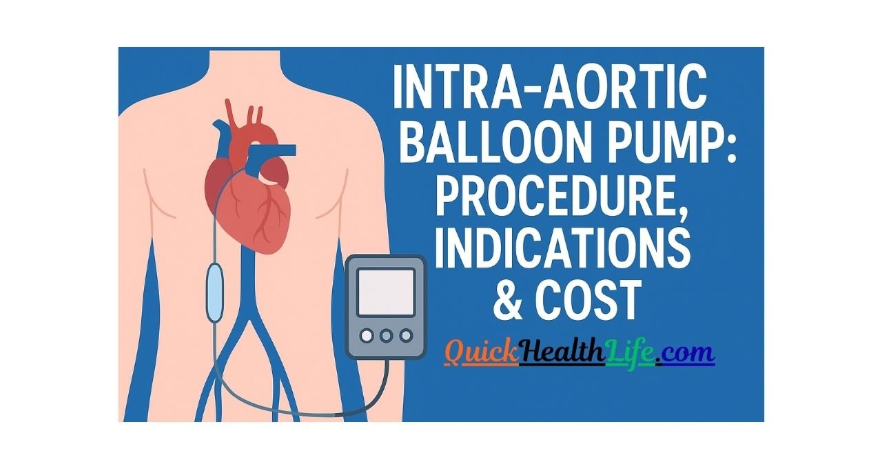 Intra Aortic Balloon Pump (IABP): Procedure, Types, Indications & Best ...